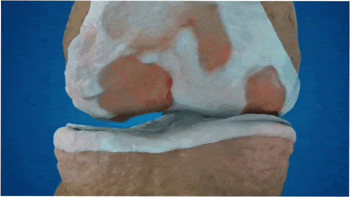 ANA BELEN CASI FUE A PRISIÓN POR DIVULGACIÓN DEL SECRETO DEL ...